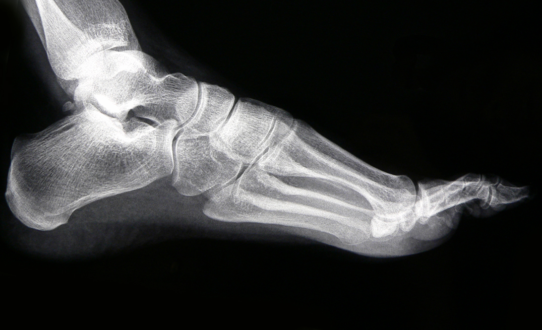 Radiography and Molecular Imaging | Excelitas